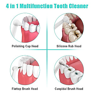 Electric Tooth Polisher, Household Dental Tartar Calculus Remover for Fighting Tooth Smoke and Tea Stains Teeth Whitening Cleaning Kit for People and Pet Dog