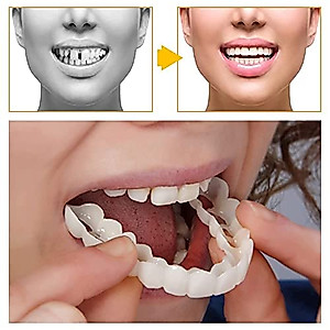 4 PCS Dentures Teeth for Women and Men, Dental Veneers for Temporary Teeth Restoration, Nature and Comfortable, Protect Your Teeth and Regain Confident Smile, Natural Shade-5