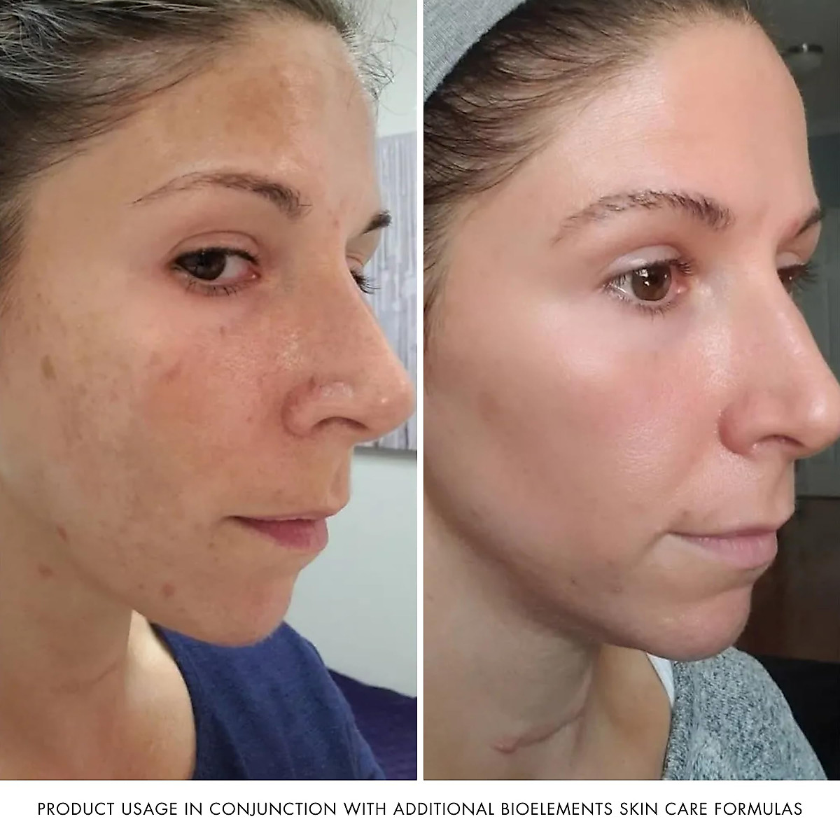 Bioelements Absolute Moisture - 2.5 oz - Lightweight Facial Moisturizer for Combination Skin - Smooth, Soft & Shine Free - Vegan, Gluten Free - Never Tested on Animals , 2.5 Fl Oz (Pack of 1)