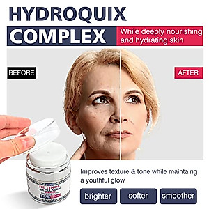 Retinol Cream for Face, Anti-Aging Facial Moisturizer with Hyaluronic Acid and Collagen, Retinol Moisturizer for Face and Neck, Wrinkle Cream for Women and Men, Day and Night Anti-Aging Moisturizing Cream – For All Skin Types