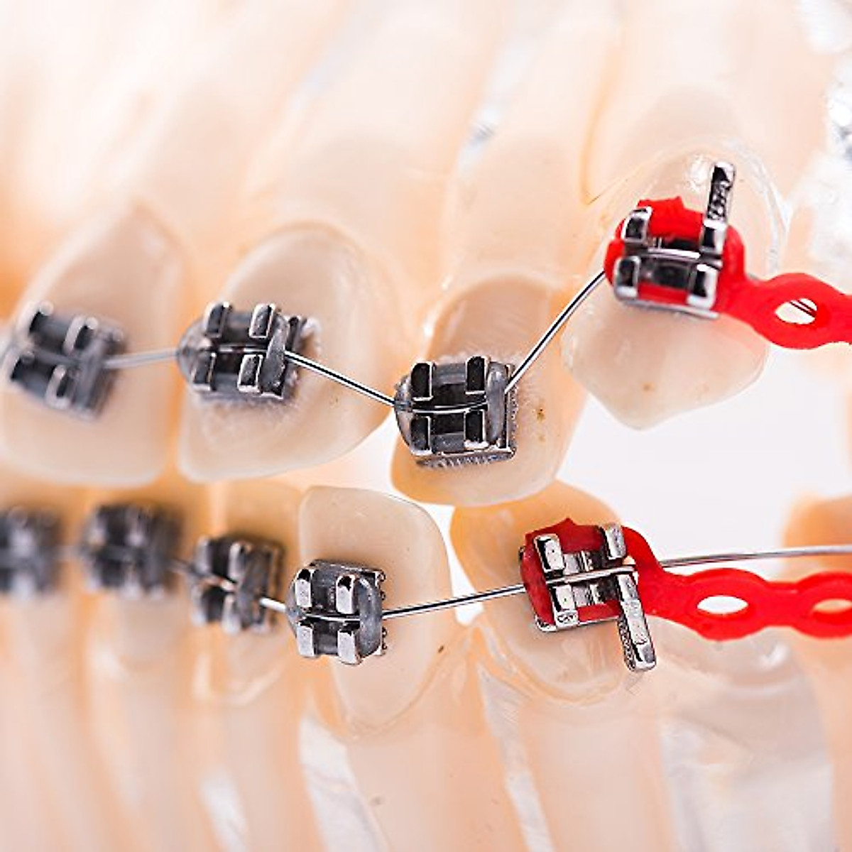 Easyinsmile Dental Orthodontic Treatment Model Teeth/Tooth/Denture Model with Braces for Dentist Studying Researching and Patient Education (Metal Bracket)