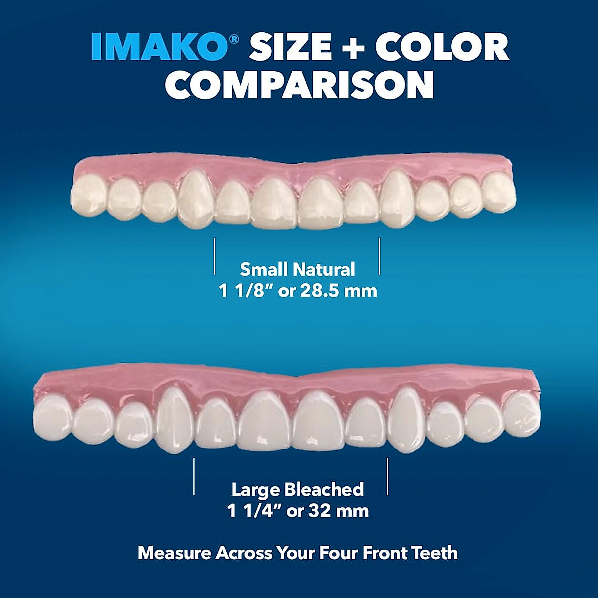 Imako Premium Cosmetic Teeth - 1 Pack - Large, Bleached White - Upper Veneers - Custom Fit at Home, DIY Smile Makeover - Made in USA