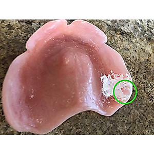 Denture Sore Spot Find And Remove Kit