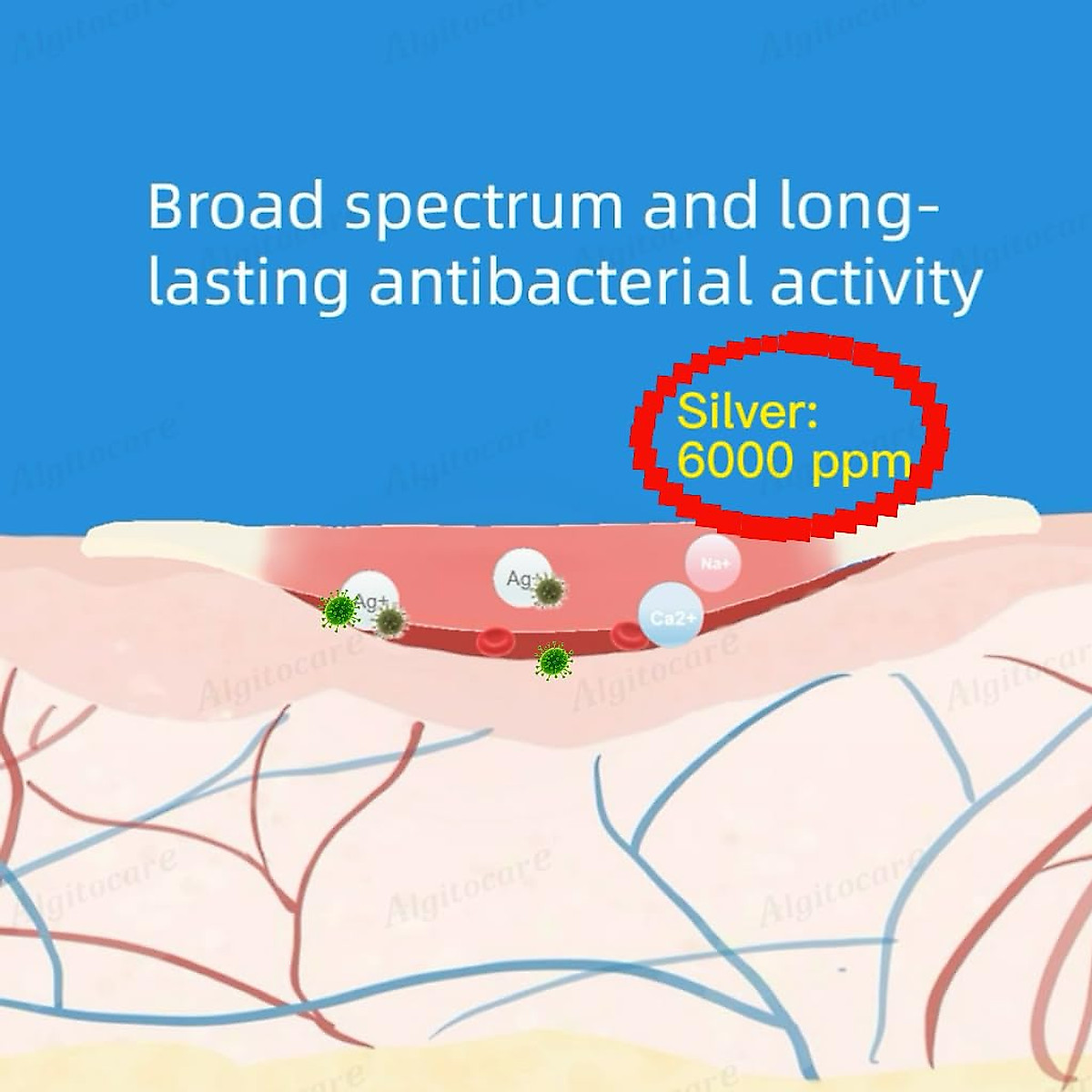 Algitocare Ag Silver Calcium Alginate Wound Dressing - 0.8"x12"(Pack of 5), Non-Stick Sterile Gauze Pads for Accelerating Wound Healing, High Absorbency and Soft for Wound Care Supplies …