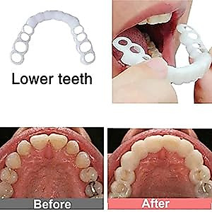 Renyqatt 2PCS Fake Teeth Adjustable Veneers Dentures Teeth for Women and Men Temporary Teeth Perfect Cover The Imperfect Teeth Nature and Comfortable (A)
