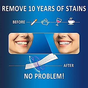 MySmile Teeth Whitening Strips 14 Treatments, 28 White Strips for Teeth Whitening, Non-Sensitive Whitening Strips for Tooth Whitening, Helps to Remove Smoking Coffee Soda Wine Stain, 10 Shades Whiter