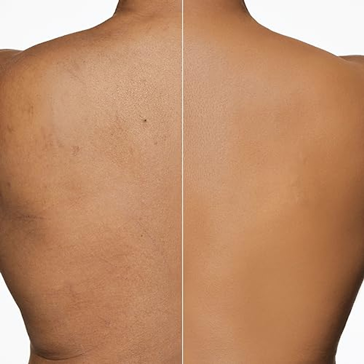 Dermablend Leg and Body Makeup Foundation