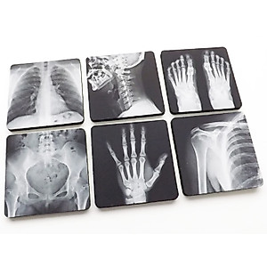 Radiology Drink Coasters Set of 4 or 6 Neoprene or Hardboard Xray Tech Imaging Radiologist Graduation Gift Doctor Nurse