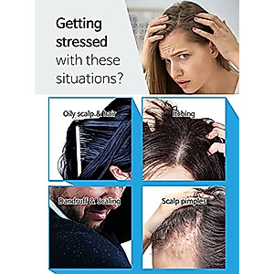 BallVic Sebo Shampoo - Itchy Scalp Trouble Care Dandruff Treatment Hair Loss Shampoo for Seborrheic Dermatitis Eczema Men and Women 2.8 Oz (230g)