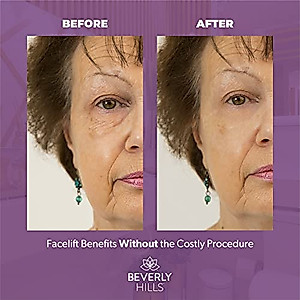 Beverly Hills Instant Facelift Anti Aging Eye Serum Treatment for Dark Circles, Puffy Eyes, Wrinkles, Under Eye Bags, Fine Lines, and Crows Feet that Works Within 90 Seconds | 30mL (120 Days Supply)