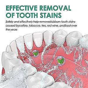 Partial & Denture Cleaner, Teeth Whitening Spray, Fast-Acting Alternative to Denture Cleaner Tablets, Teeth Cleaning & Teeth Whitening Spray, Denture Spray Freshens Breath (2PC)