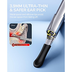 ScopeAround Otoscope Ear Camera, Ear Wax Removal Tool 1080p FHD Video Otoscope, 3.9mm Ear Wax Removal Camera with 6 LED Lights Visual Ear Scope, Compatible with iPhone15 & Android