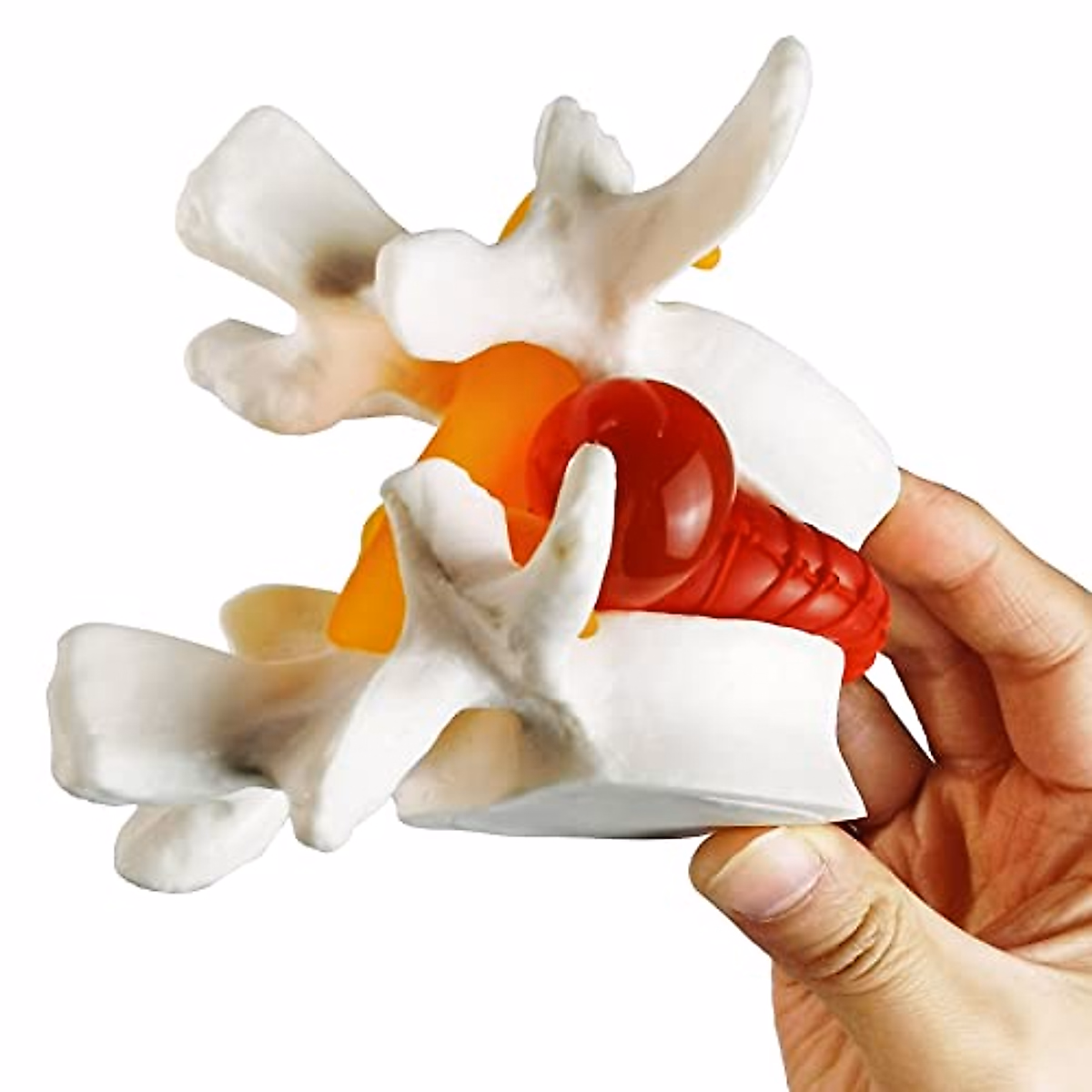 2023 New Human Anatomical Lumbar Herniation Model, Vertebrae Degenerative Lumbar Human Spine Model 1PCS,Lumbar Spine Model for Teaching & Learning - Excellent Way for Demonstrating Disc