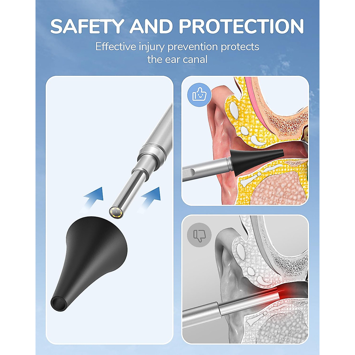 Ear Specula Set for ScopeAround Digital Otoscope, Set of 50 Pieces, Replacement Otoscope Tips, Ear Speculum, Compatible with ScopeAround SA39W/SA39i/M28/MS450 Otoscope