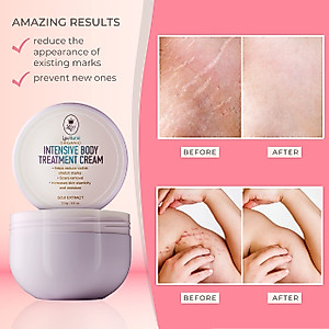 Levitural Stretch Mark & Scar Removal Cream for Pregnancy, Postpartum (2-in-1) - Maternity Skin Care Moisturizer Stretch Mark Prevention with Antioxidant Goji Extract - EXTRA LARGE Volume (8.8 Oz)