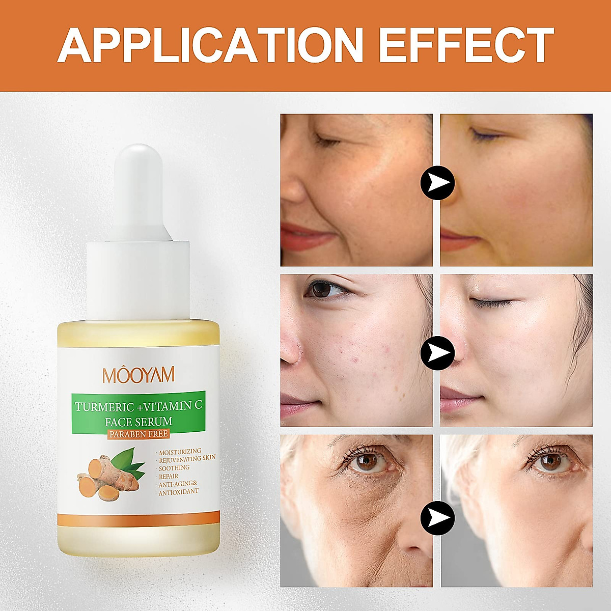 Turmeric Dark Spot Corrector Serum Turmeric and Vitamin C Serum for Face Dark Spot Correcting Glow Serum Dark Spot Remover for Face Tumeric Serum Acne Dark Spots Hyperpigmentation Smooth Skin 1oz