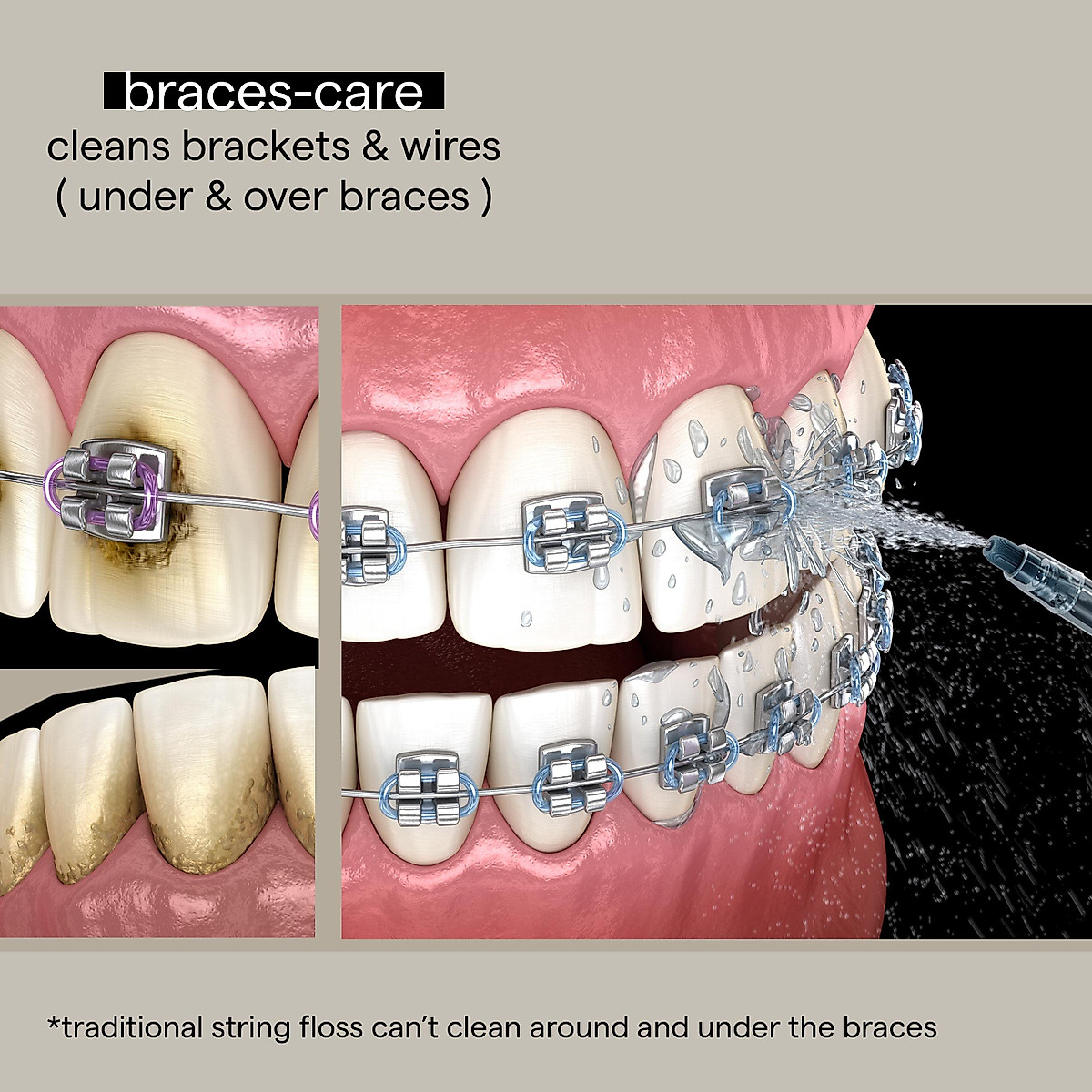 MOUTHARMOR Mouth Armor Cordless Water Flosser & Electric Toothbrush Combo (Mouth Armor + Dental Floss)