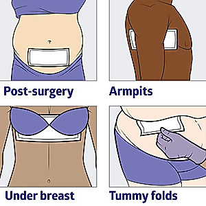 Medline Skinfold Dry Sheet, Skin Moisture Management, Soft, Non-Chafing, Pre-Cut & Ready to Use, 6" x 14" (10 Count)