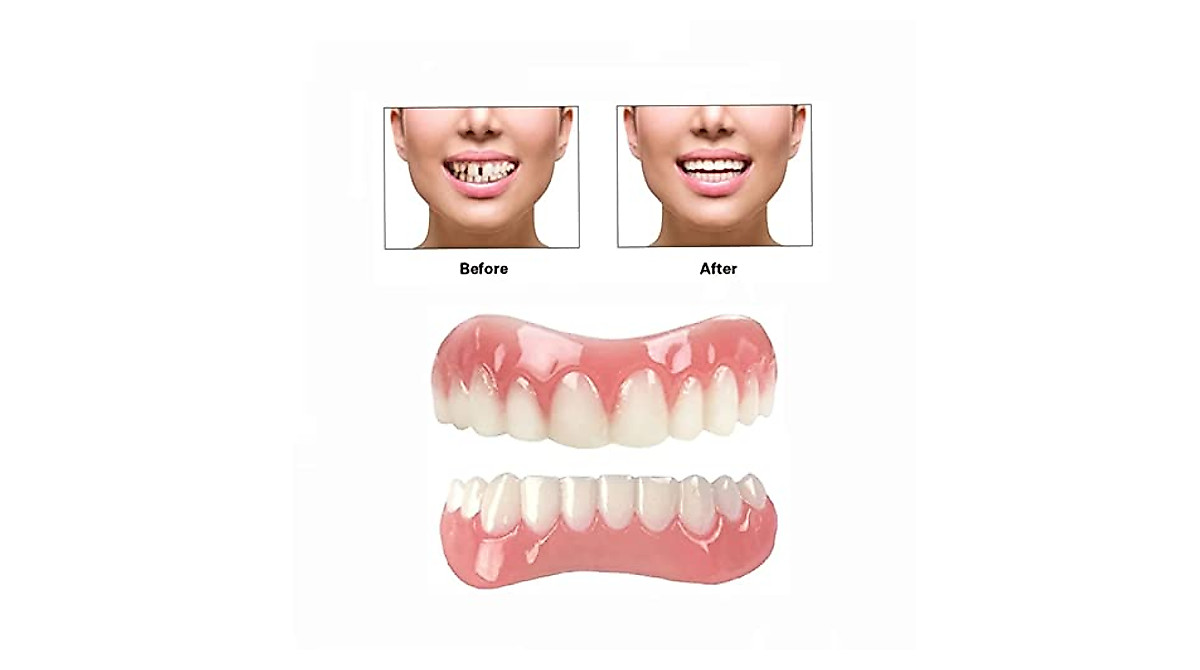 Fake Teeth Veneers – Instant Smile Fix for Men & Women