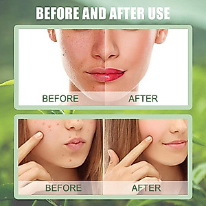 Atheniz Blackhead Remover, Reetata, Laoneto Blackhead Remover, Sea Scouts Blackhead Remover (1Pack)