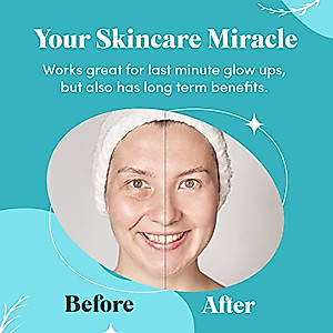 Hydra Blue Collagen Under Eye Gel Mask - Bright Eyes Anti Aging Treatment For Dark Circles, Puffy Eyes, Bags, Fine Lines - 30 Pairs (60 Total Patches)