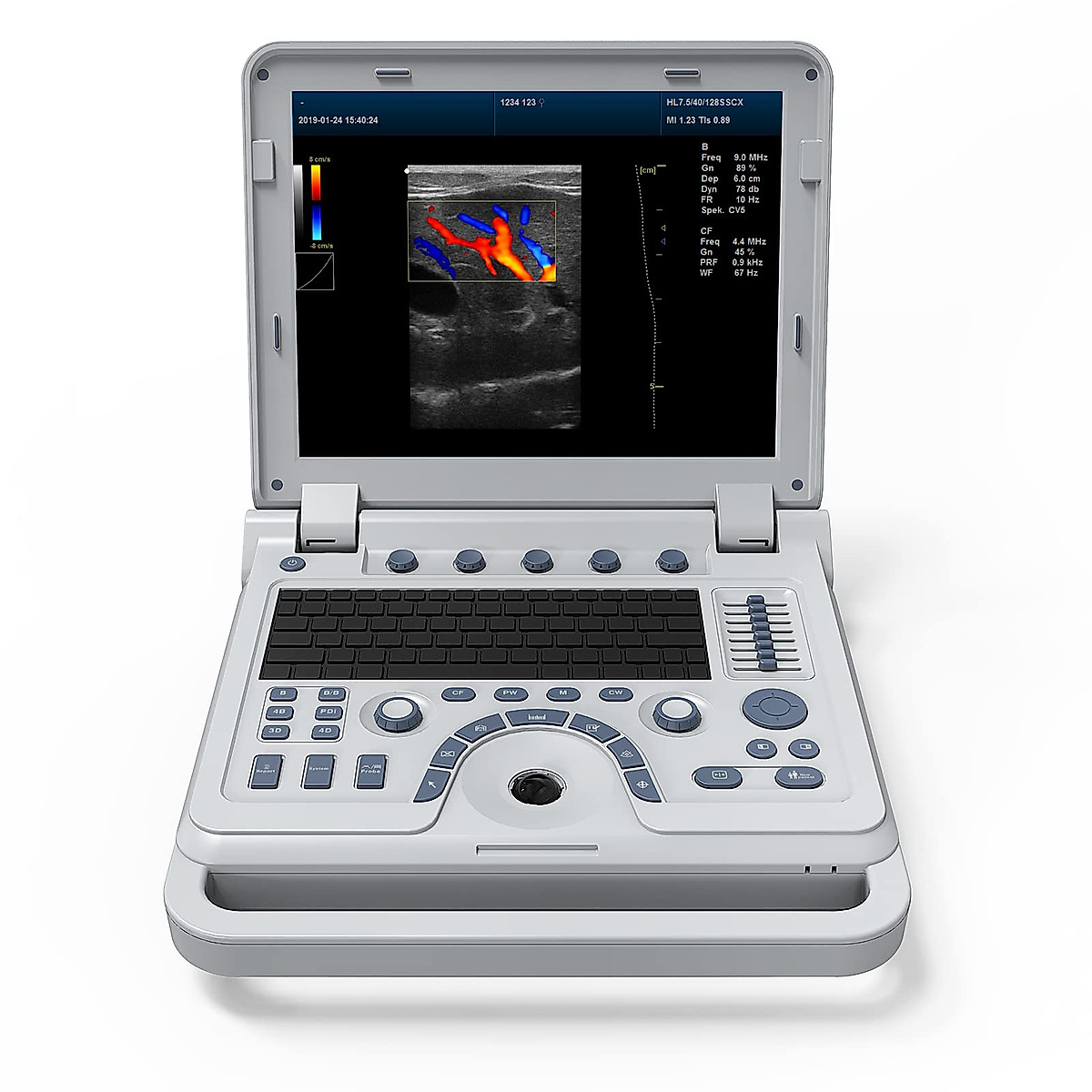 CONTEC Veterinary Ultrasound Scanner Color Doppler for Pregnancy in Animals/Goats/mare/Horses with 7.5Mhz endo-Rectal Probe
