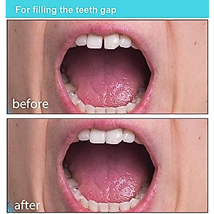 Tempoary Tooth Repair Kits DIY Dental Care Kit Glue for Filling Missing Broken Teeth Crowns and Bridges Moldable Fake Teeth to Regain Your Beautiful Smile in Minutes-White Color