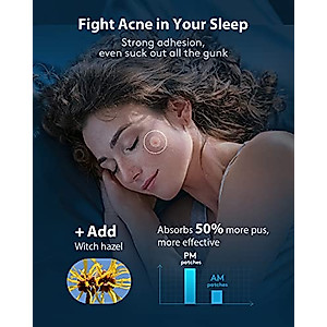 LitBear Acne Pimple Patches- Day and Night 4 Sizes 180 Dots Thin & Thick Hydrocolloid Patches with Witch Hazel, Tea Tree & Calendula Oil, Extra Adhesion Pimple Patches for Face Zit Patch Acne Dots