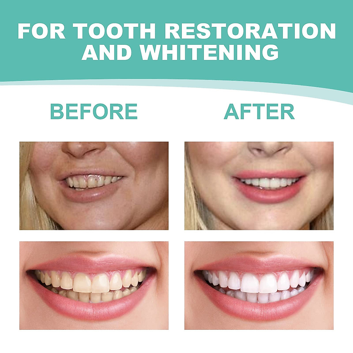 2 Pairs Snap on Dentures for Women with Missing Teeth, Veneers Snap in Teeth for Men, Comfort Confident Smile Cover The Imperfect Teeth