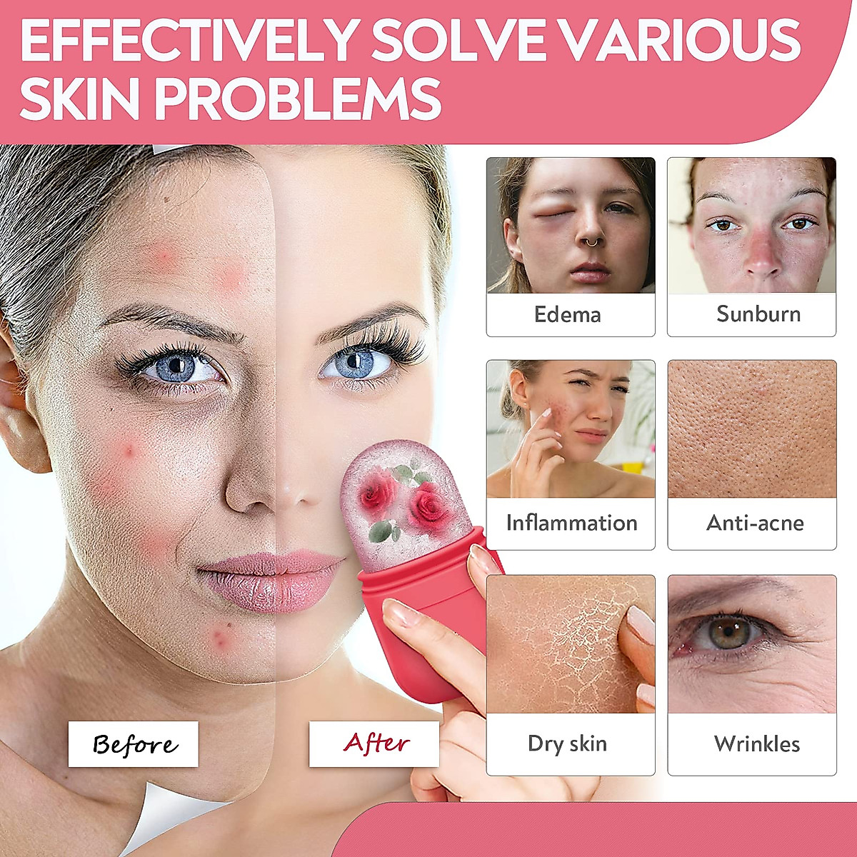 AURUZA 2PCS Ice Roller for Face and Eye, Ice Facial Roller Beauty Self Skin Care Tools Ice Holder Facial Cube Gua Sha Face Massage Ice Mold for Face Anti Wrinkle Tighten Skin Women Gifts…