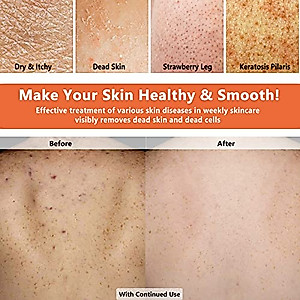 2 in 1 Exfoliating Glove & Back Scrubber for Shower - Exfoliating Body Scrubber for Soft Skin, Dead Skin Remover for Body Exfoliator, Back Exfoliator, Korean Exfoliating Mitt for Body, Shower Gloves