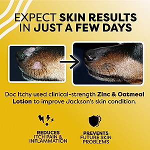 Doc Itchy: Allergy Armor Itch Relief Conditioner & Leave-on-Lotion | Clinical-Strength Zinc & Oatmeal | Banish Rashes, Calm Itch, Rebalance Skin Microbiome | Nurture Skin Health | Made in USA | 12 oz