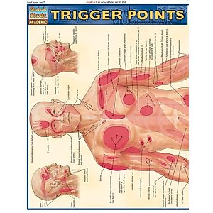 Trigger Points QuickStudy Laminated Reference Guide (QuickStudy Academic)