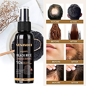 Venanoci Hair Growth Serum, Rice Water Spray for Women & Men Treatment For Hair Loss, Damaged Dry Hair, Hair Regrowth for Thicker Longer Fuller Hair with Castor oil Ginger