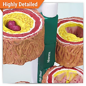 4-Piece Artery Model | Human Body Anatomy Replica of Artery w/Plaque Build Up for Doctors Office Educational Tool | GPI Anatomicals