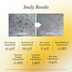 APRILSKIN Calendula Flower-Infused Facial Peel Off Mask, 3.52 fl. oz, PHA, BHA & Niacinamide gently exfoliates, removes impurities, improves uneven skin tone, and minimizes pores, Korean Skincare