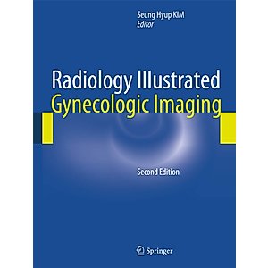 Radiology Illustrated: Gynecologic Imaging