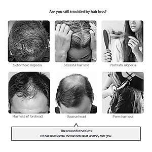 Hotiary Caffeine Hair Growth Shampoo, Hair Loss Treatment Shampoo Strenthen Hair Root Promote Hair Regrowth Thickness Activate Scalp 6.76 fl oz