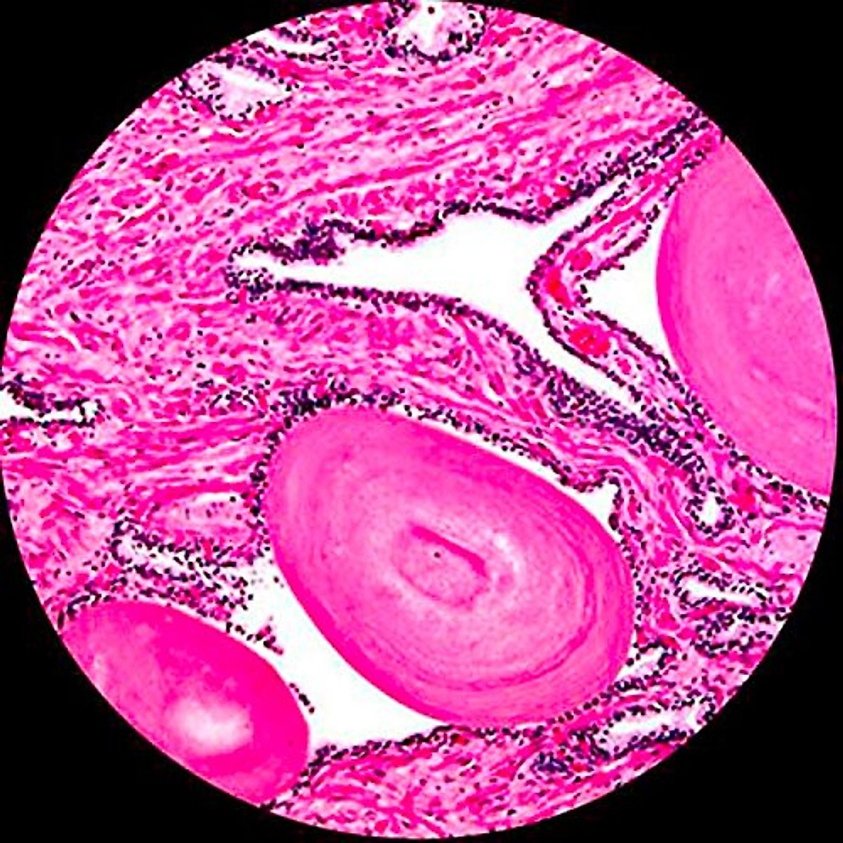 AmScope PS100B Prepared Microscope Slide Set for Basic Biological Science Education, 100 Slides, Set B, Includes Fitted Wooden Case