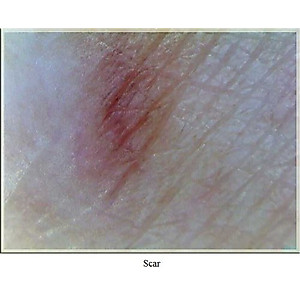 Firefly DE350 Wireless Polarized Handheld Digital Dermatoscope/Microscope