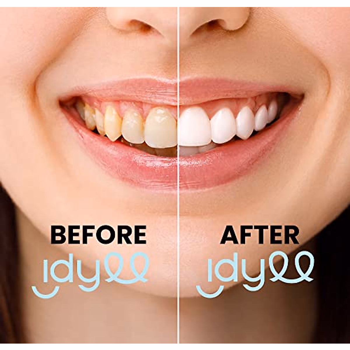 Plaque Disclosing Gel Pens for Teeth, 150 Uses, Dental Disclosing Tablet Gel for Kids & Adults - Shows Plaque, Helps Teach Kids Teeth Brushing Habits for Clean Teeth - by Idyll