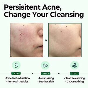 SOME BY MI AHA BHA PHA 30 Days Miracle Cleansing Bar - 3.73Oz, 106g - Mild Exfoliating Body Cleansing Soap - Moisturizing Effect, Pore and Sebum Care for Sensitive Skin - Body Skin Care