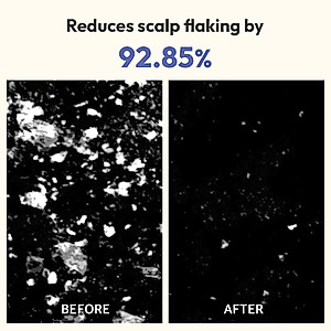 BEIGIC Volumizing Shampooing Scrub – Korean Haircare Vegan Scalp Exfoliator & Shampoo w/Sacha Inchi Oil & Sea Salt for Buildup, Flakes, Clarifying Itchy Scalp (8.81 Oz)