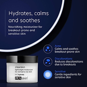 PCA SKIN The Acne Control Skin Care Set (Kit Includes BPO Facial Cleanser, Niacinamide Face Cream, Salicylic Acid Acne Gel, Retinol Treatment)