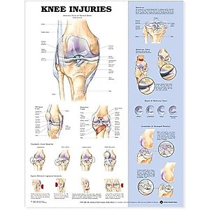 Knee Injuries Anatomical Chart