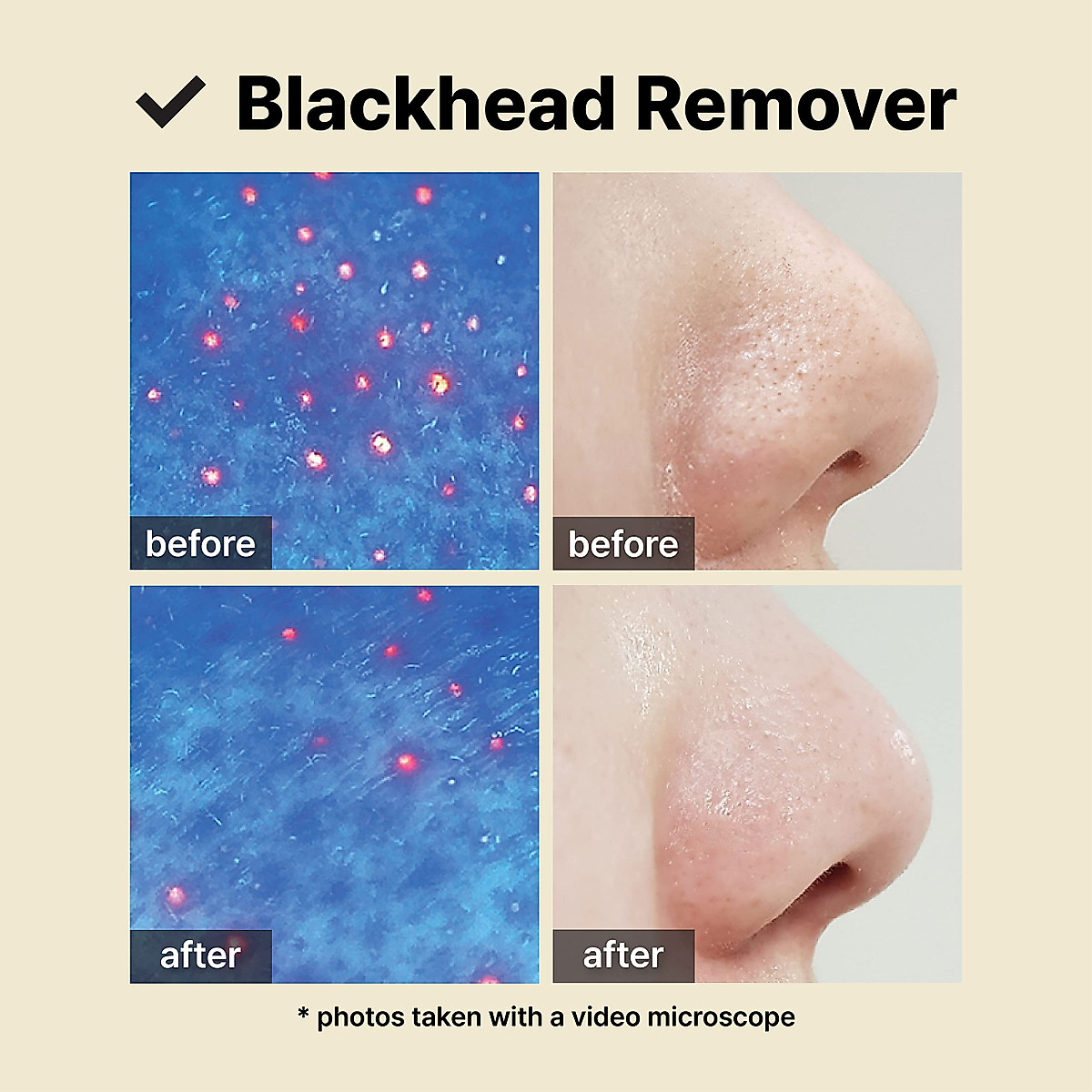 MAKEPREM Safe me. Relief Moisture Cleansing Oil 7.1 Fl Oz Naturally-Derived Ingredients PHA Formula Makeup Remover Pore Cleansing Blackhead Removal Hypoallergenic and Clinically Tested Oil Cleanser