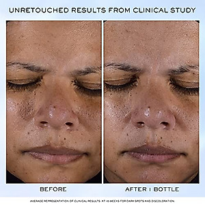 Lancôme Clarifique Pro-Solution Face Serum - Brightening Serum For Visibly Reducing Dark Spots & Acne Spots - With 10% PHA and Niacinamide - 1.0 Fl Oz