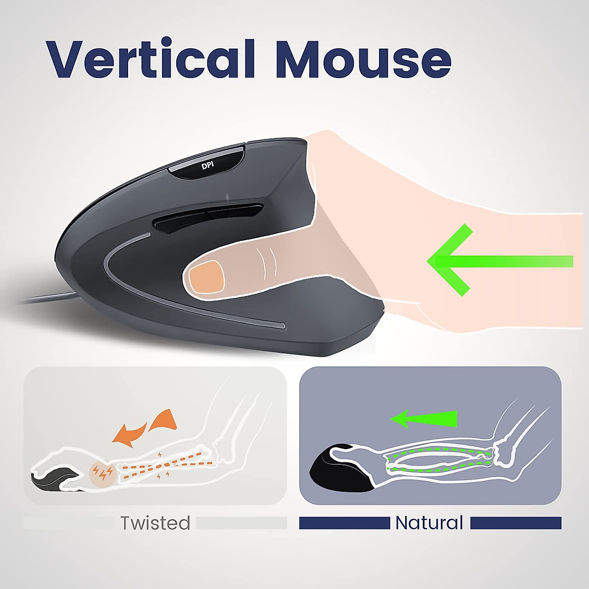 Perixx PERIDUO-512B US, Wired Ergonomic Keyboard and Vertical Mouse Combo - USB - Black - US English