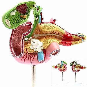 BoNew Human Duodenum Gall Bladder Disease Anatomy Medical Model Life Size