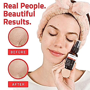 Retinol Serum for Face with Hyaluronic Acid, Hydrating Night Serum for Face, Retinol for Acne, Wrinkle & Dark Spots, Anti Aging Serum, Retinol for Face, Skin Care Face Serum for Men & Women by YEOUTH